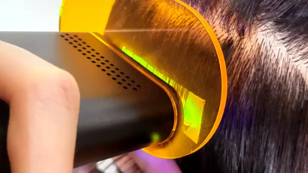 How To Remove V Light Hair Extensions?